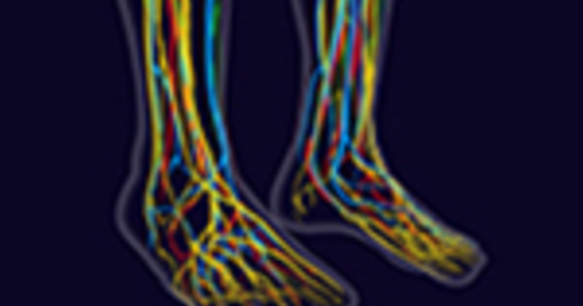New Treatments Show Promise for Disease Modification in Painful DPN ...
